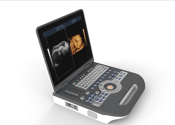 Medical Ultrasound Machine Portable Ultrasound Scanner 4d Ultrasound ...