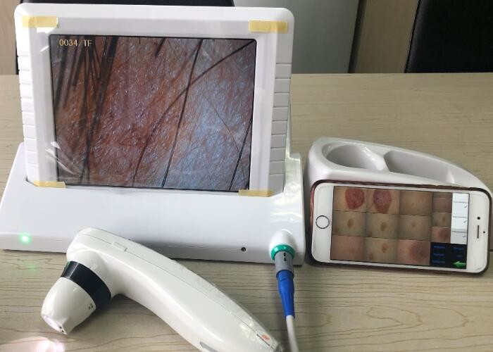 Digital Handheld Video Dermatoscope with 8 Inch Screen 1,4,9 Pictures ...