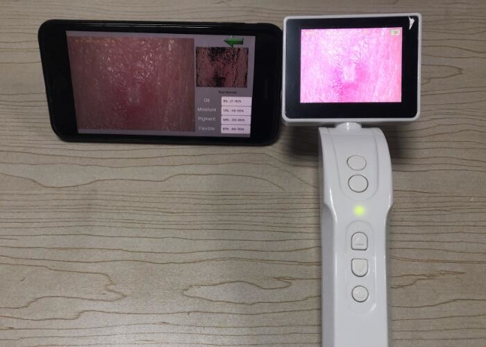 Handheld Digital Dermatoscope Video Dermatoscope Wifi Connection to ...