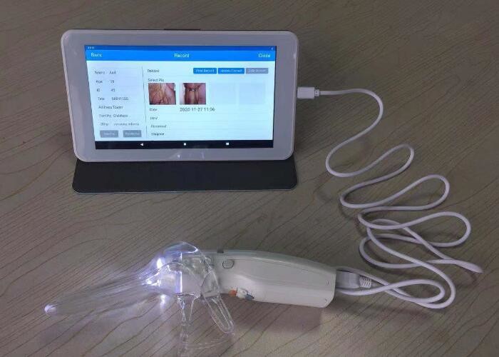 Digital Video Colposcope for Woman Care 10 or 7 Inch Medical Monitor ...